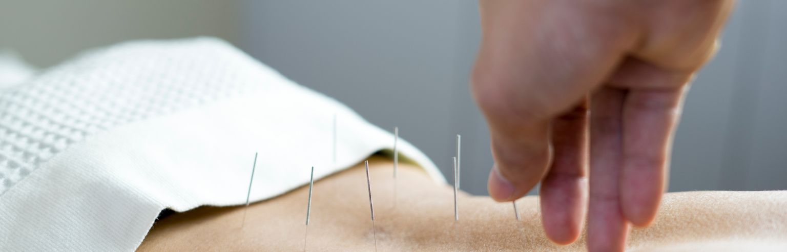Best Acupuncture Langley BC | #1 Licensed Acupuncturists